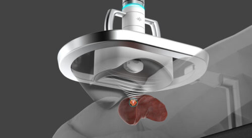 These bubbles kill cancer - Michigan Engineering News