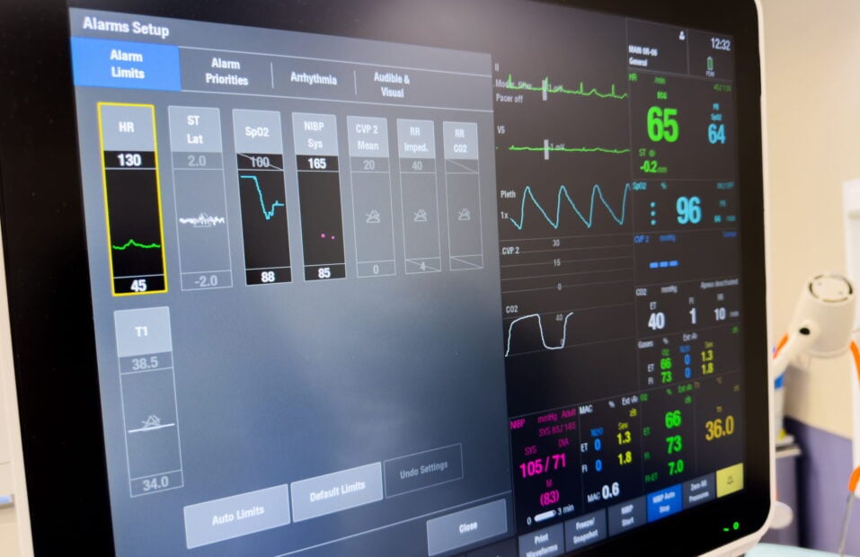 Widely Used Ai Tool For Early Sepsis Detection May Be Cribbing Doctors