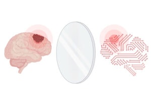 Brain tumor digital twin predicts metabolic treatment outcomes ...